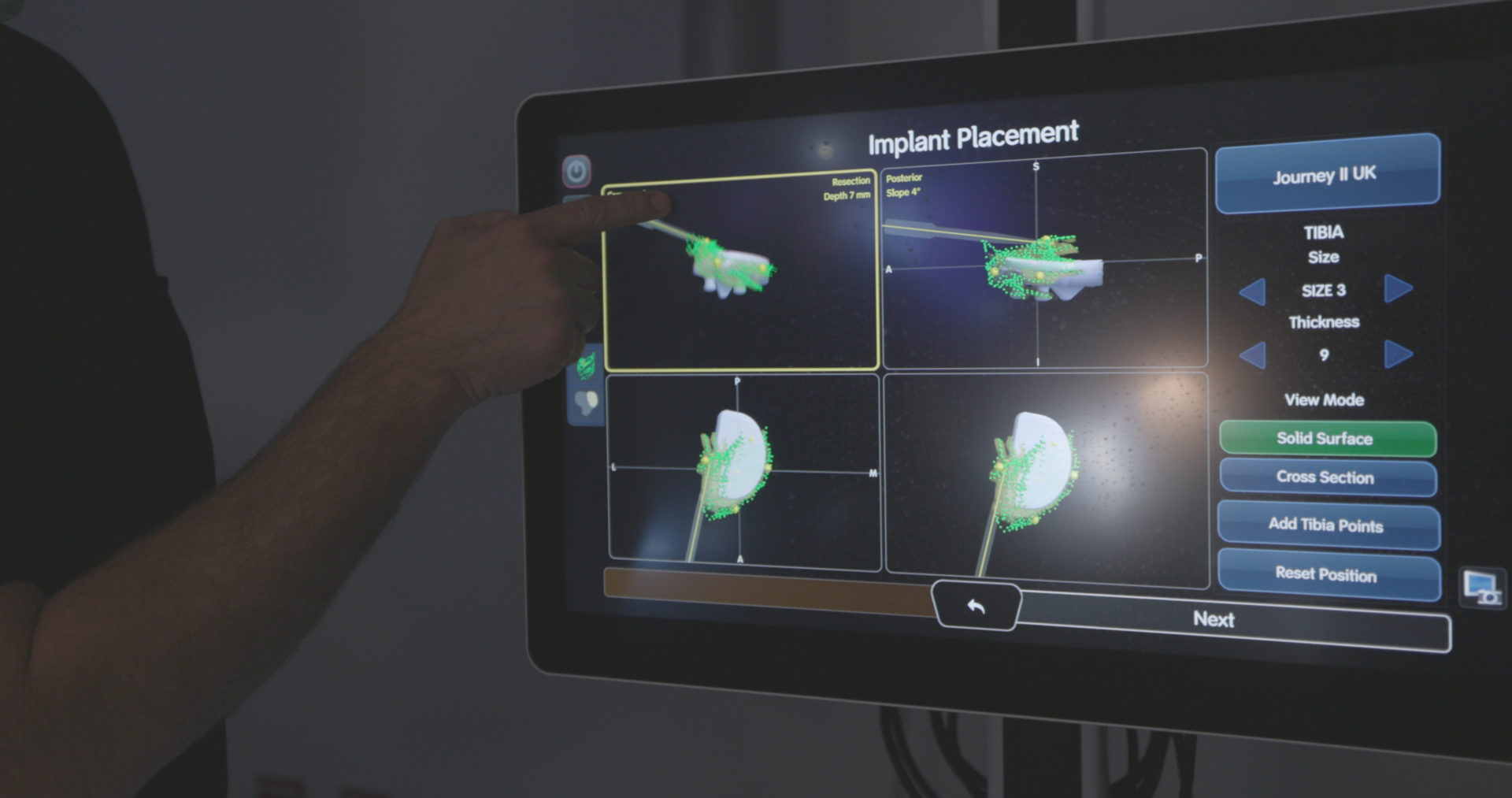 CORI Surgical System | The Joint Replacement Center of Scottsdale